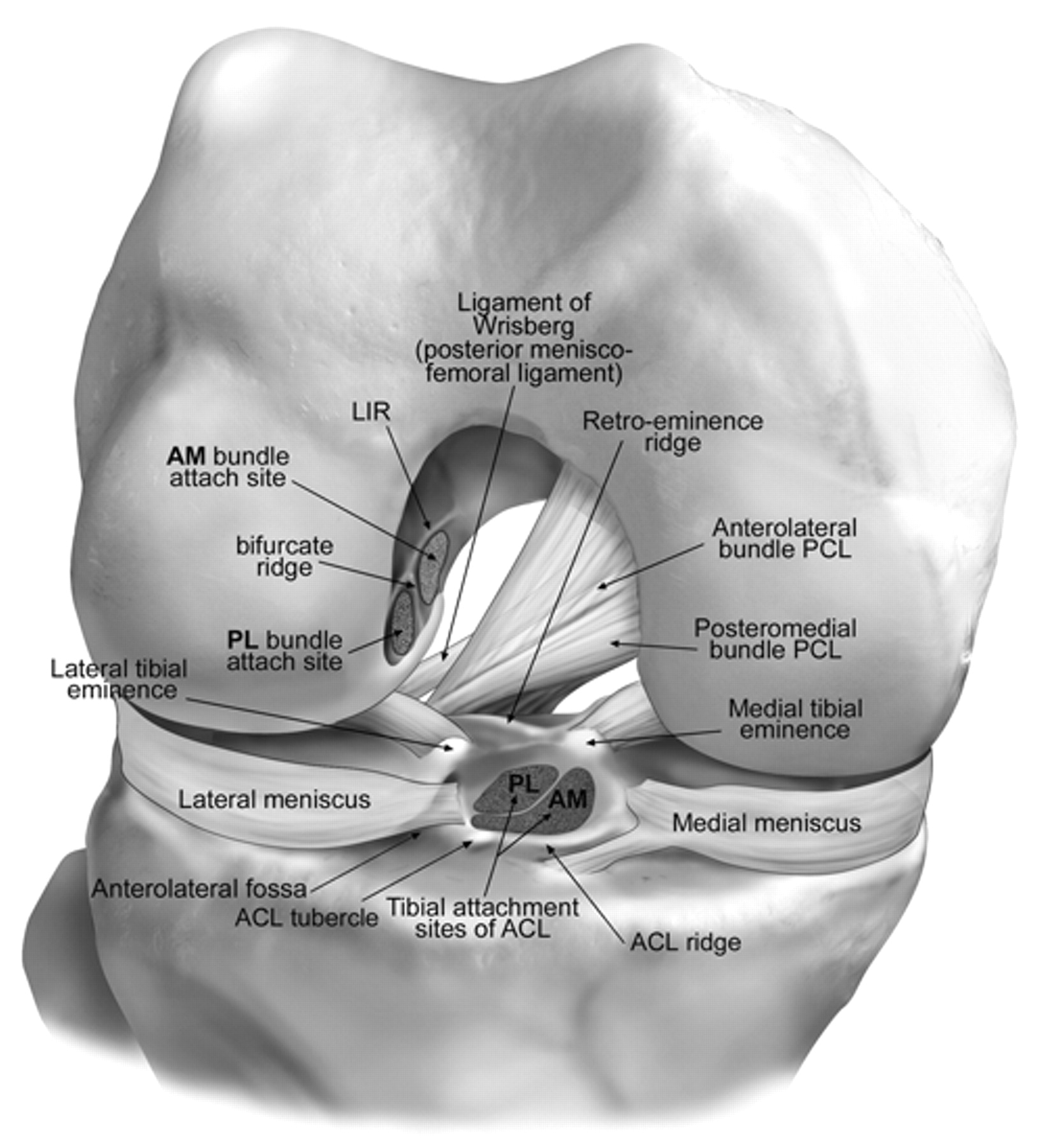 ACL Arthroscopic Landmarks Dr Bu Balalla