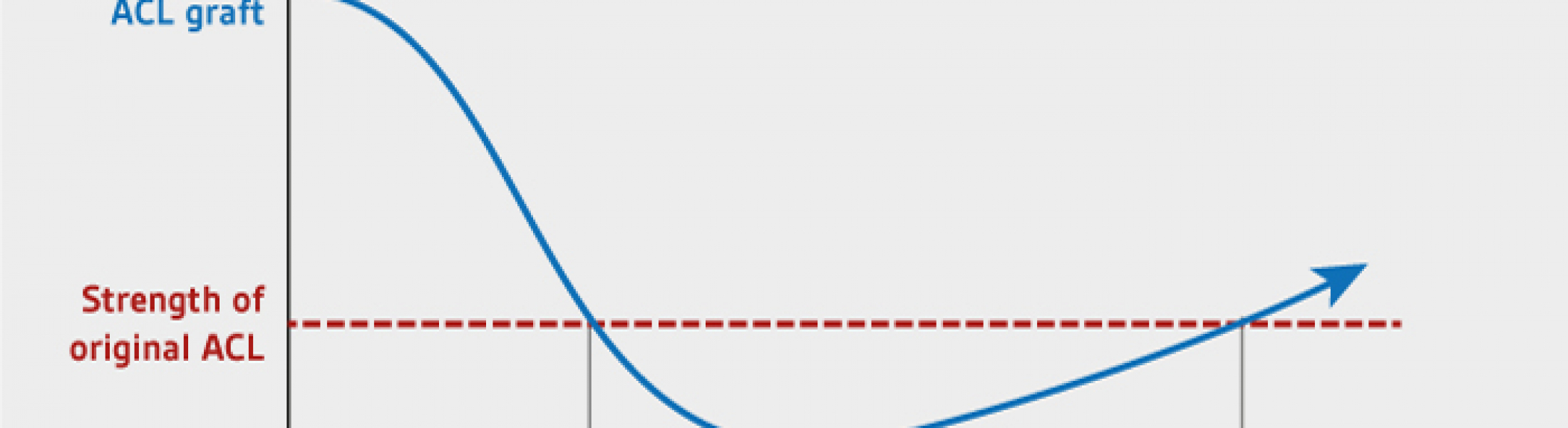 ACL-strength - Dr. Bu Balalla