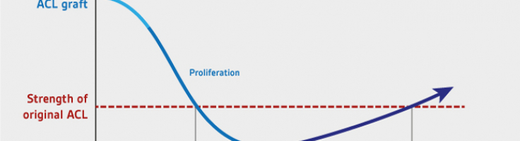 ACL-strength-v2 - Dr. Bu Balalla