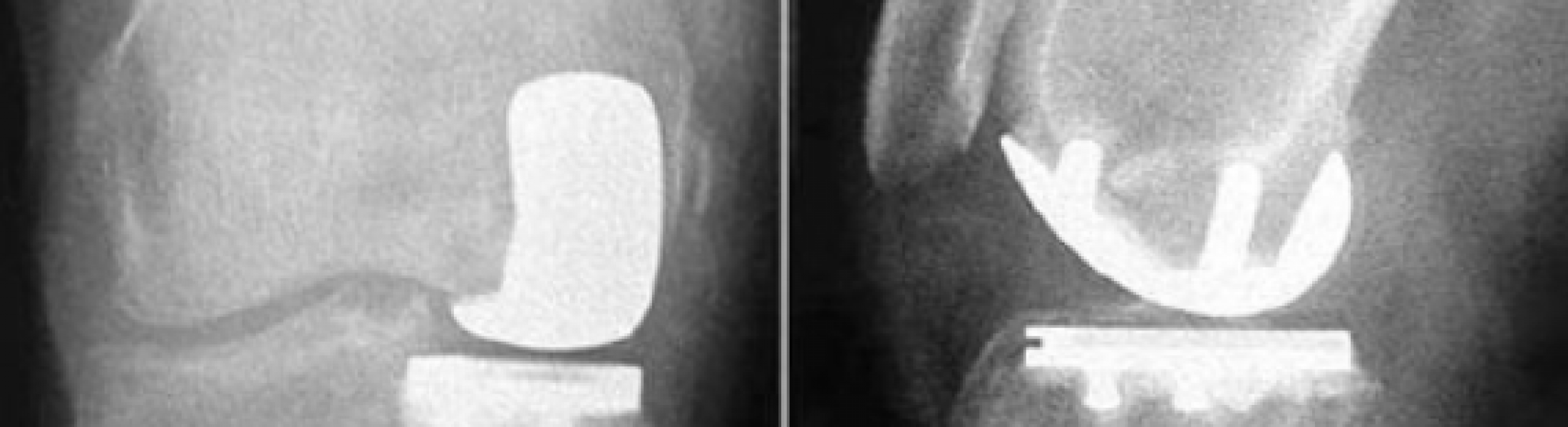 UKR xray - Dr. Bu Balalla