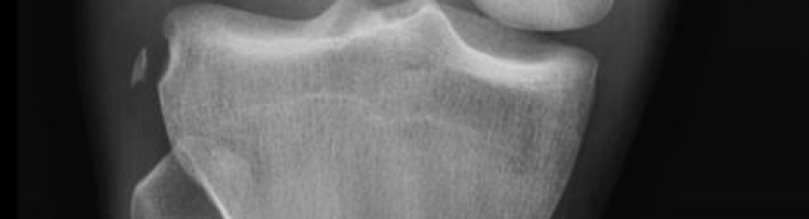 segond - Dr. Bu Balalla